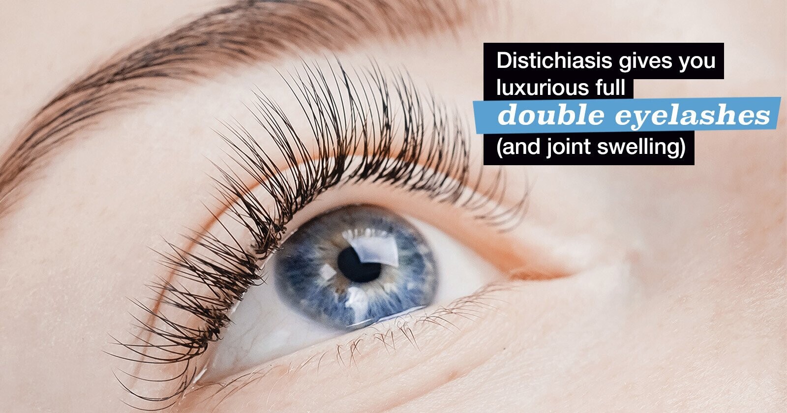 Double Row Eyelashes Mutation