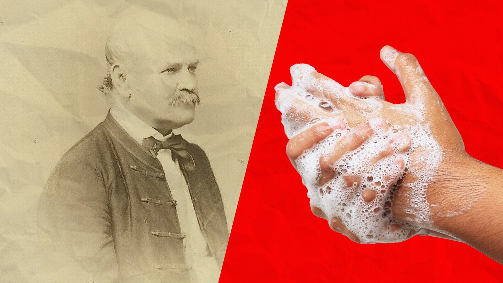 The ‘Father of Handwashing’ Died a Cruel, Ironic Death | Cracked.com