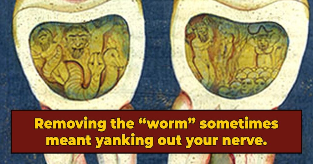 People Used To Blame Cavities On Evil Tooth Worms | Cracked.com