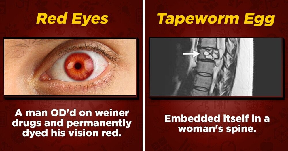 5 Real Medical Stories That Are Pure Skin-Crawling Horror | Cracked.com