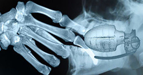 5 Insane Doctors From History Who Put House to Shame | Cracked.com