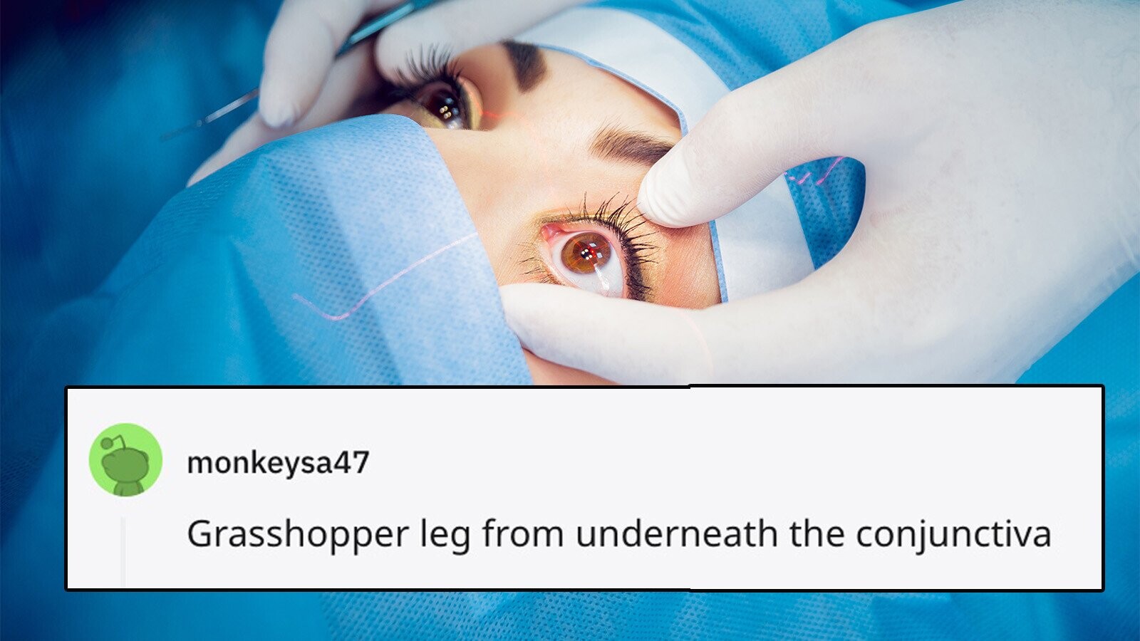 31 Funny, Weird or Gross Things Surgeons Have Removed from People’s ...