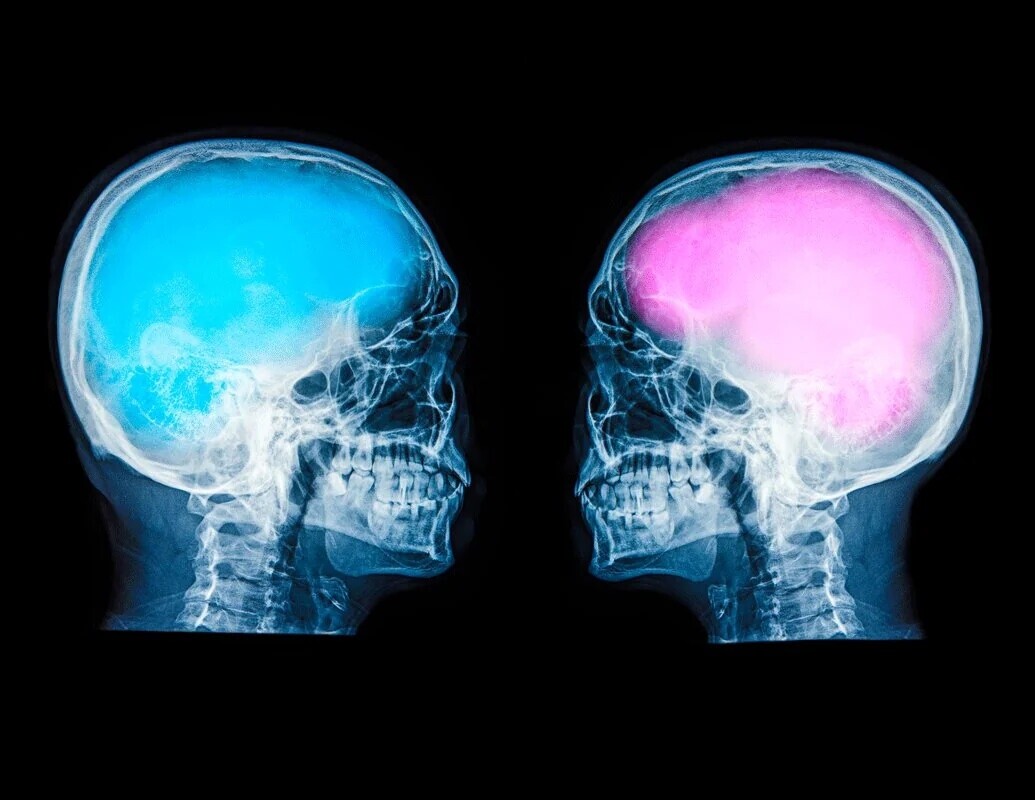 18 Extra-Wild Facts to Shock Your System | Cracked.com