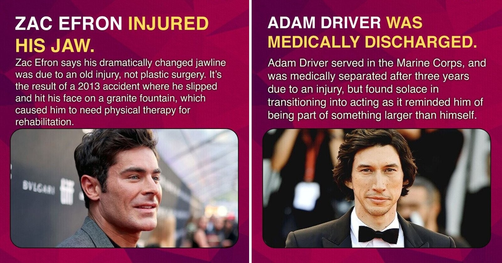 15 Actors With Physical (And Emotional) Scars That Helped Their Craft ...