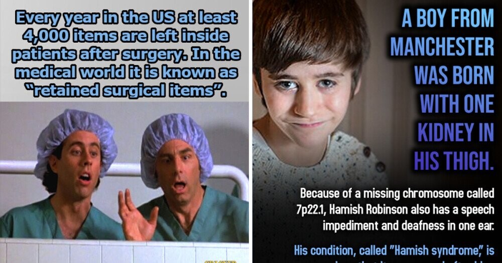 33 Medical Oddities We Can’t Believe Are Real | Cracked.com