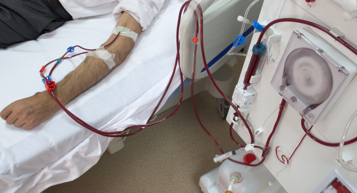 No Peeing, Or Beer: 6 Realities Of Life Without Kidneys | Cracked.com