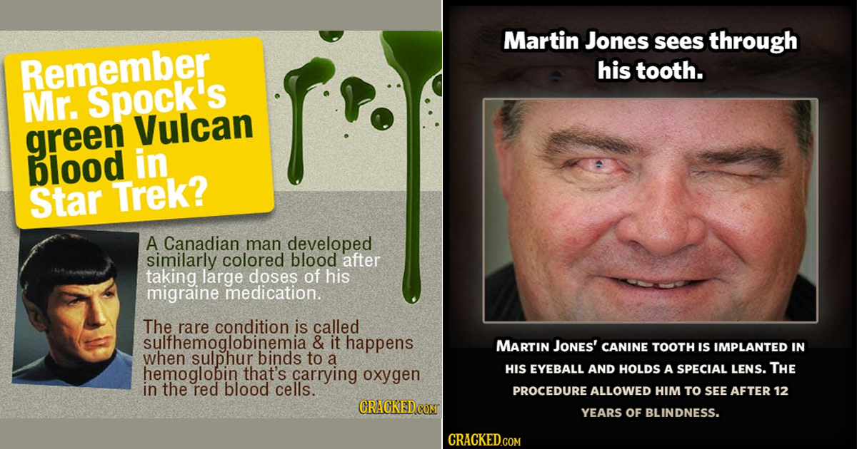 22 Weird Medical Facts That’ll Bring Conversations To A Halt | Cracked.com